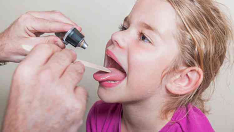 Akut Ve Kronik Tonsillit Ne Demek Bulaşıcı mı? Bitkisel Tedavisi - PUWIKI