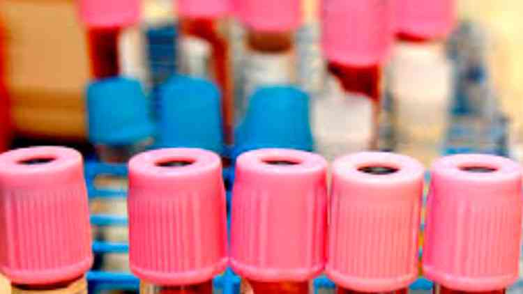 ADH Hormonu Antidiüretik Vazopressin Hormon Nedir Nereden Salınır?